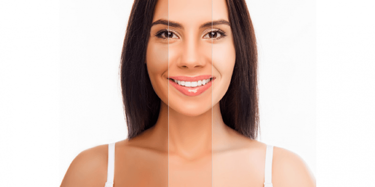 Skin Bleaching Malaysia - Permanent & Effective Solutions (All Skin Types)